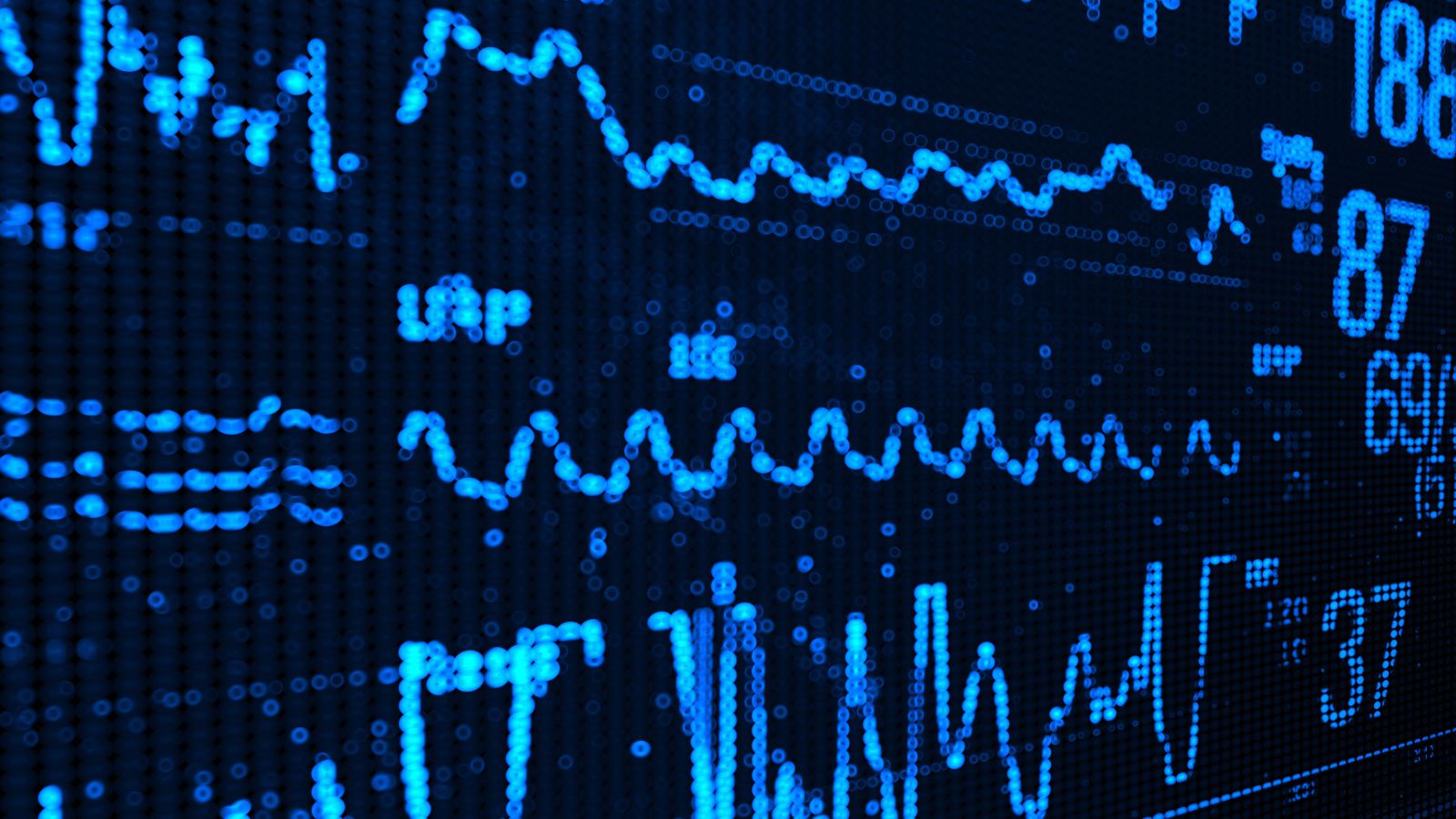 What to Look for in an EEG Brain Scan System for Your Practice ...